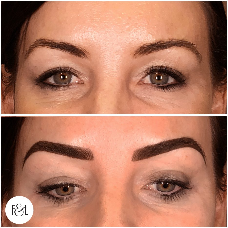 Combo Brows Before and After Photos Gold Coast
